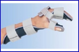 Wrist Orthosis | Hand Splint | Hand Orthosis | Custom Orthotics | Orthosis