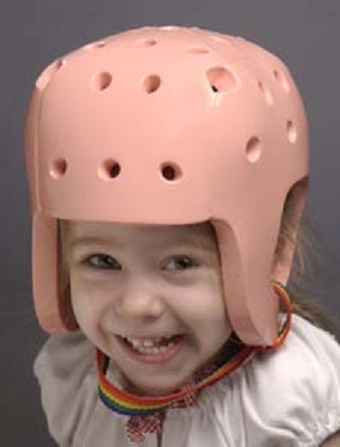 Special Needs Protective Childrens Helmets | Protective Headgear | Baby ...