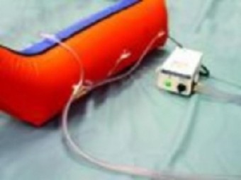 Lymphedema Pump | Leg Compression Machine | Lymphedema Treatment | Bio ...