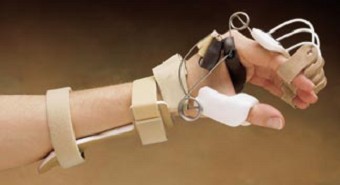 Wrist Orthosis | Hand Splint | Hand Orthosis | Custom Orthotics | Orthosis