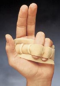 Hand Splints | Finger Splints | Resting Hand Splints - ON SALE - Wrist ...