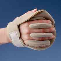Hand Contracture | Hand Splints | Discounts | Orthosis | Ulnar ...
