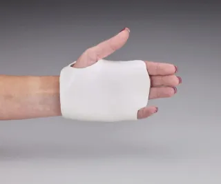 Hand Based Digit Orthosis for Immobilization and Stabilization During ...