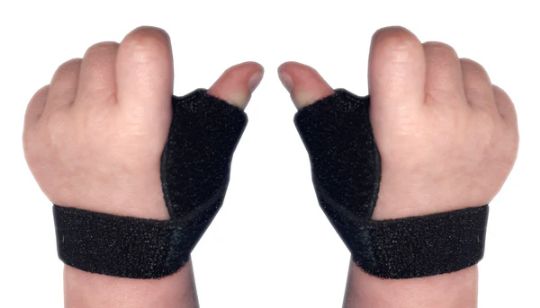 Neonatal Thumb Splints by McKie Splints
