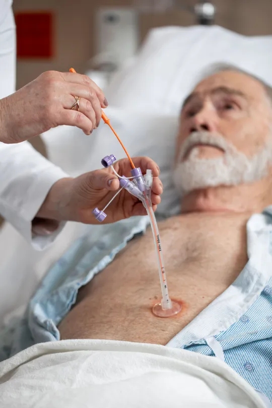 Enteral Feeding Tube DeCloggers by Bionix