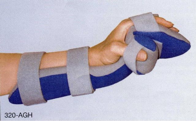 Hand Contracture | Hand Splints | Discounts | Orthosis | Ulnar ...